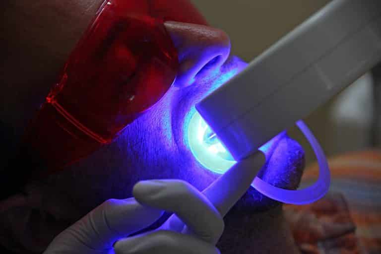 What To Know About Viral ‘Veneer Techs’—And Why Dentists Warn Against ...